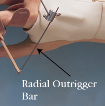 Phoenix Extended Outrigger Kit - North Coast Medical